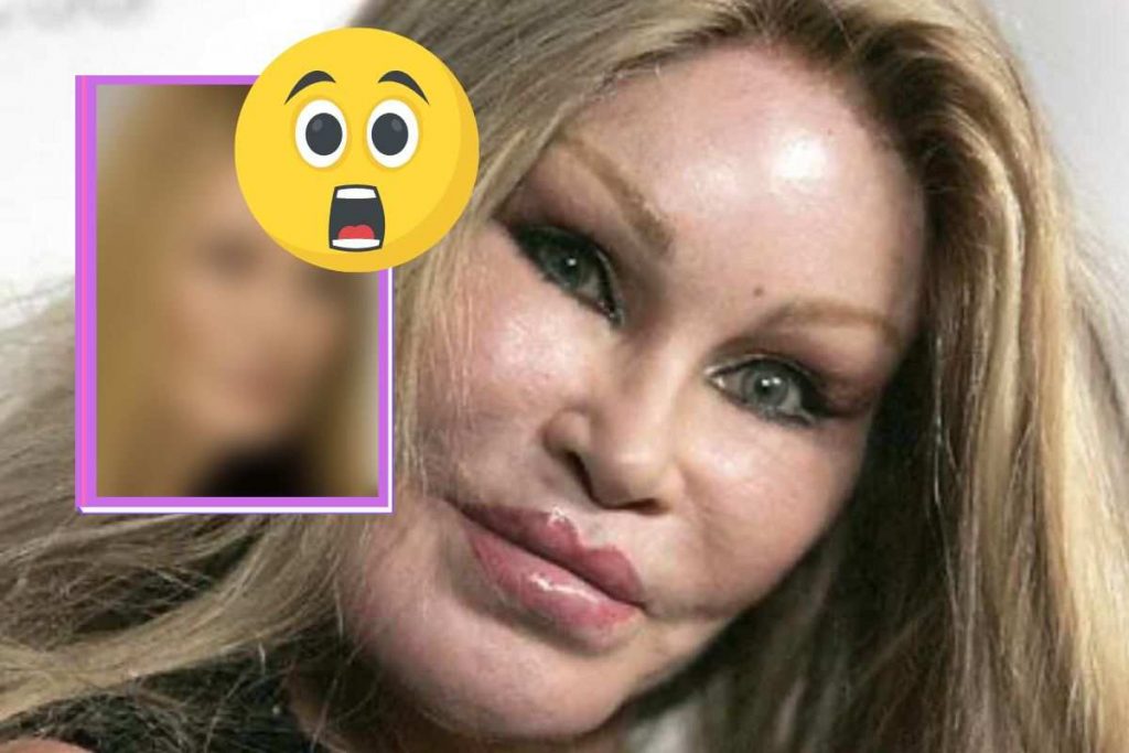 Avete mai visto la donna gatto prima della chirurgia: era di una bellezza sconvolgente - Newsby